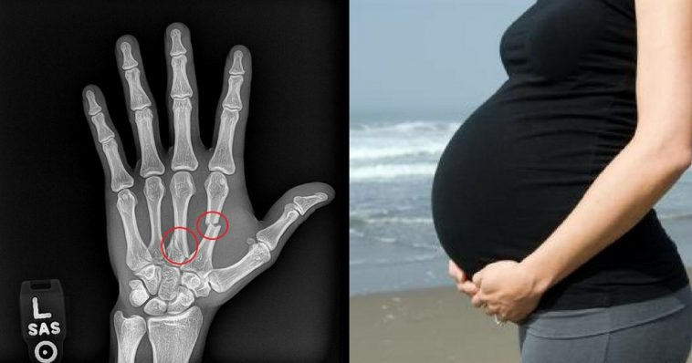 14 Fascinating Facts About Left-Handed People We Bet You Didn't Know ...