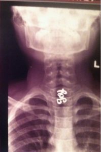 What Really Happens When You Swallow Your Gum? | DoYouRemember?