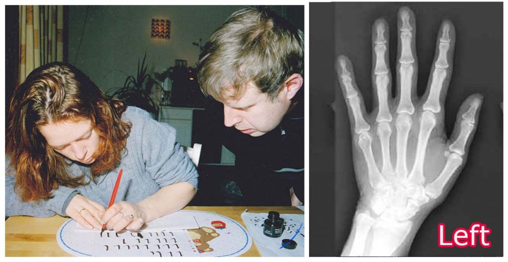 Studies Show Lefties People Are Likely To Be Smarter Than Righties