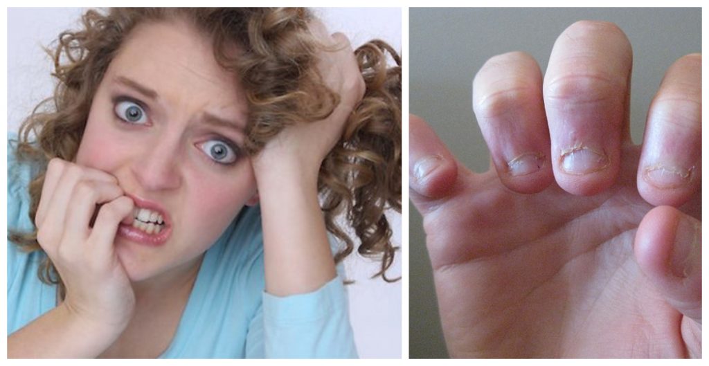 Research Finally Reveals The Real Reason We Bite Our Nails