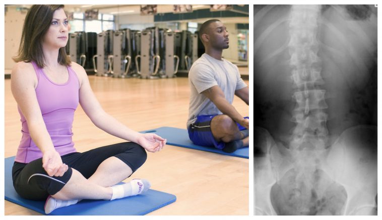 Studies Show Americans Desperately Need To Improve Their Posture