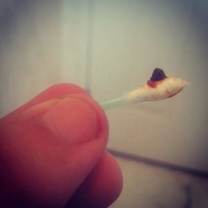 7 Signs Of Health Issues Your Earwax Could Reveal