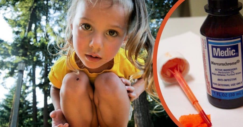 Mercurochrome, A Kid's Nightmare, Won't Be Around Anymore