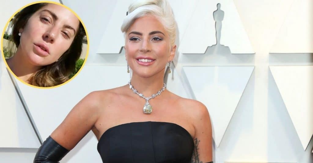 Lady Gaga Stuns Makeup-Free While Soaking Up The Summer Sun