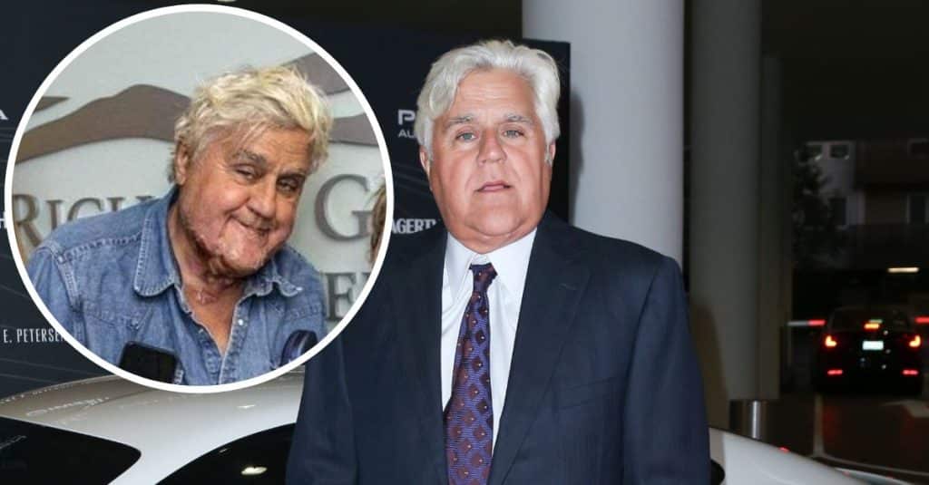 Jay Leno Jokes About Getting A Third Face And “Brand New Ear” After ...