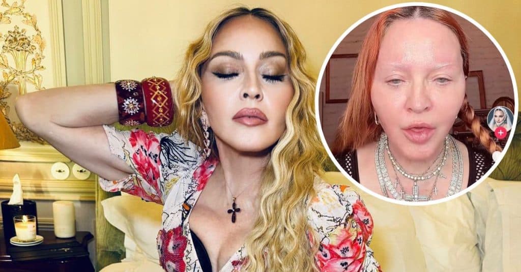 Plastic Surgeon Points Out Madonna's Surgery Tweaks As New Photo Raises ...