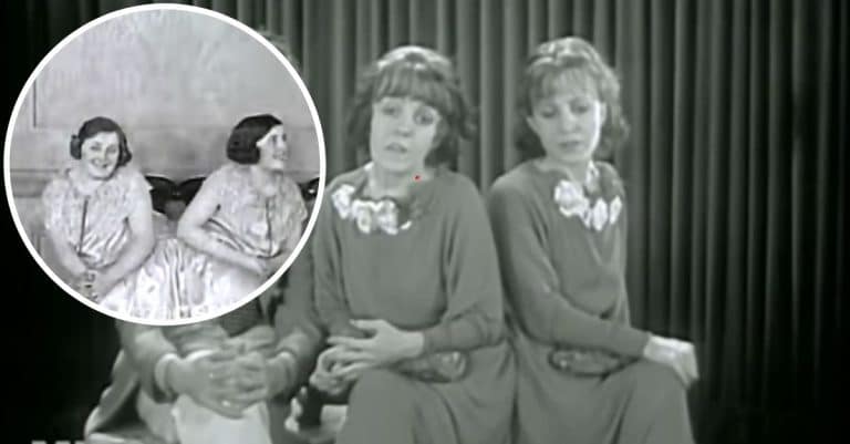 Conjoined Twins Born In 1912 Chose To Remain Physically Attached — Here ... Conjoined Twins Born In 1912 Chose To Remain Physically Attached — Here ...