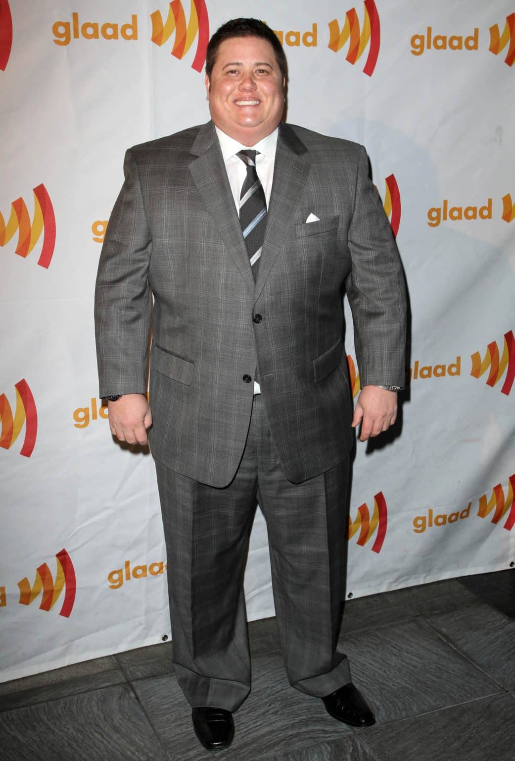 Chaz Bono’s Remarkable Weight Loss Journey From Before ‘DWTS’ To Today